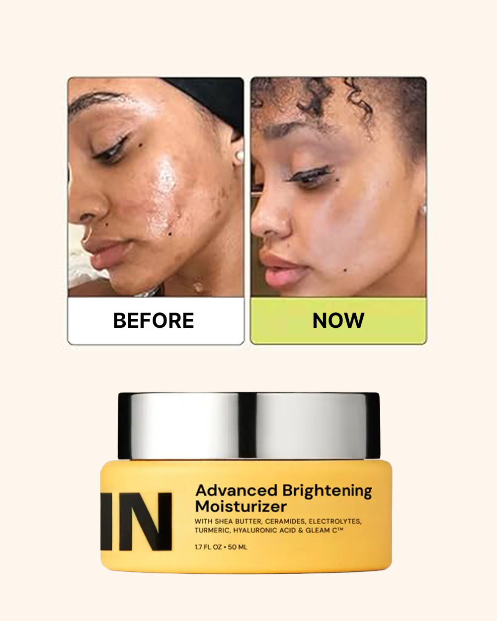 Advanced Brightening Moisturizer – Curveez